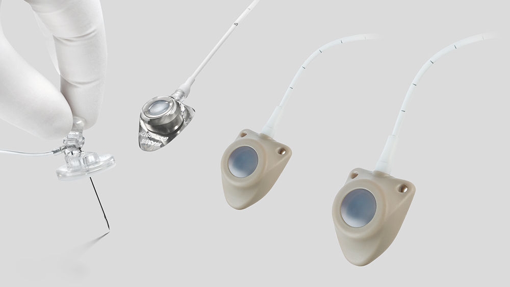 Portkatheter und Portkanülen für den Gefäßzugang